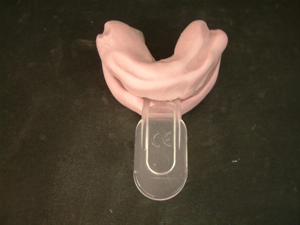 Total removable prosthesis protocol – Laboratorio Maurizio Melano ...